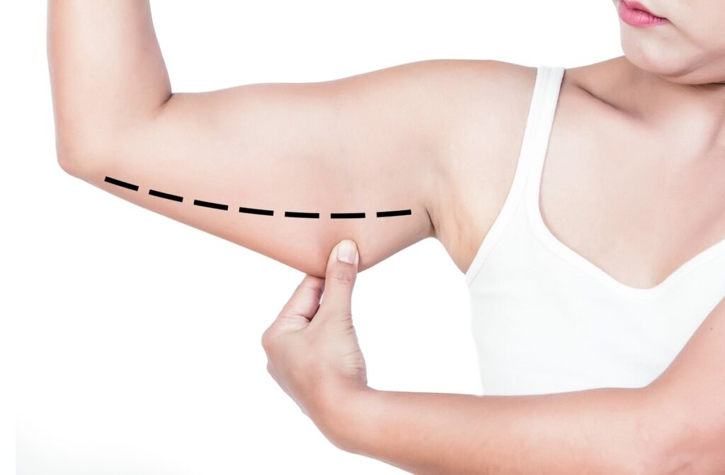 The Link Between Inflammation and Fat Storage: New Studies Explained ...